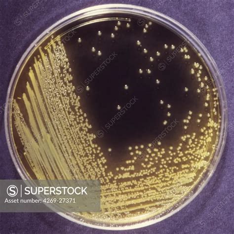 Cholera Bacteria Gram Stain