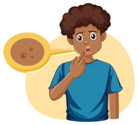 270 Teenager With Acne Clip Art Stock Illustrations Royalty Free