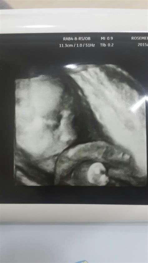 정밀초음파 보고왔네요ㅎ