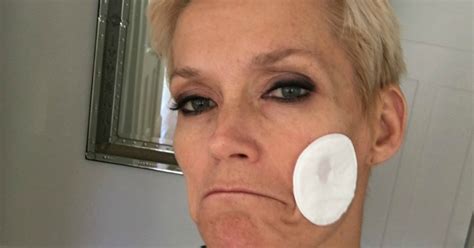 Adult Acne Why Its Different What Causes It And How To Treat It