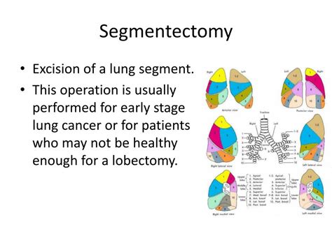 Ppt Cardiothoracic Surgery Powerpoint Presentation Free Download Id 2466176