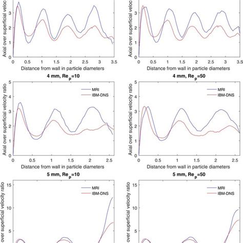 Pdfs Of Experimental Values Measured With Mri And Simulated Ibm Dns