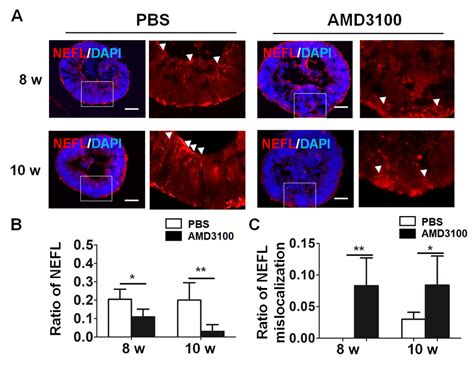 Cxcr4 Blockade Leads To Abnormal Neuronal Axon Outgrowth In Retinal