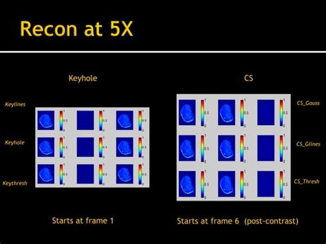 Introduction To Compressed Sensing Mri Pdf