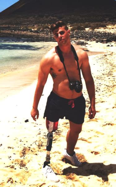 Prosthetic Photographer Tumbex