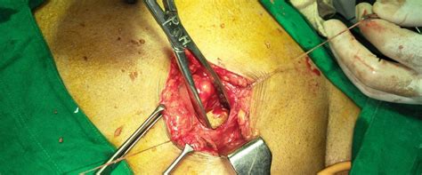 Urosurgery Sadiccha Hospital Goodwill Hospital Panvel