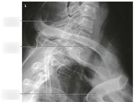 Swimmers View X Ray