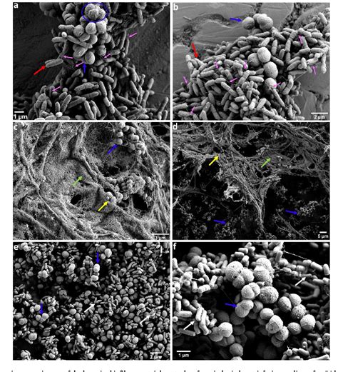 Figure From Interspecies Interactions In Dairy Biofilms Drive Community Structure And Response