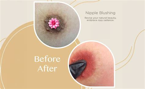 Areola Flower Tattoos Dont Get A Lotus Tattoo Before Watch This