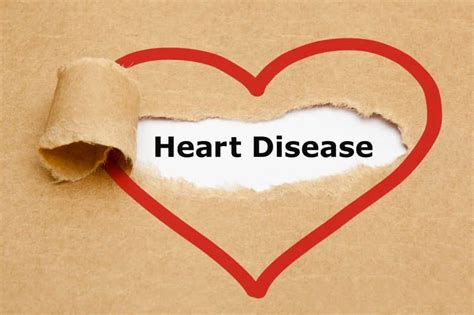 chest x ray heart disease risk axis imaging news