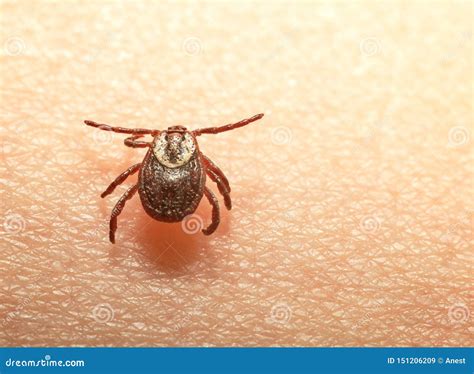 Tick On Human Skin Stock Image Image Of Sucker Close 151206209