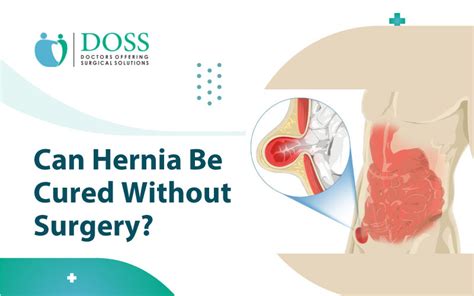 Can You Heal A Hernia Without Surgery Doss India