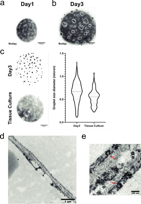 A Confocal Image Of Primary Human Adipocytes Isolated From