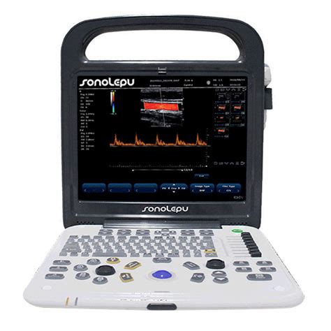 Easy To Operate Diagnostic Ultrasound System For Hospital At Best Price