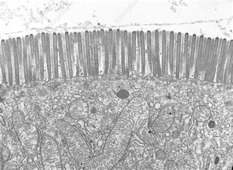 Microvilli Tem Stock Image C055 3593 Science Photo Library