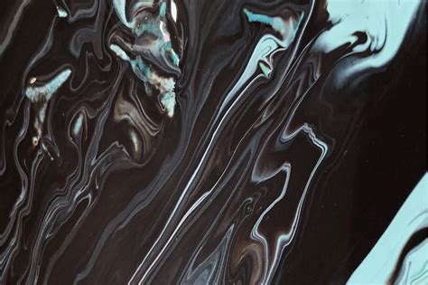 Normocytic Normochromic Anemia