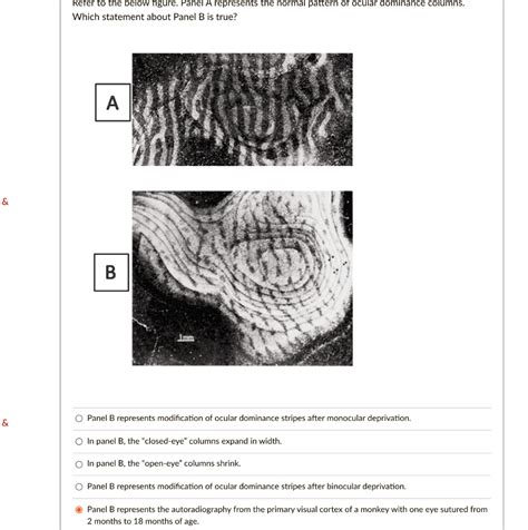 Solved Refer To The Below Figure Panel A Represents The Normal