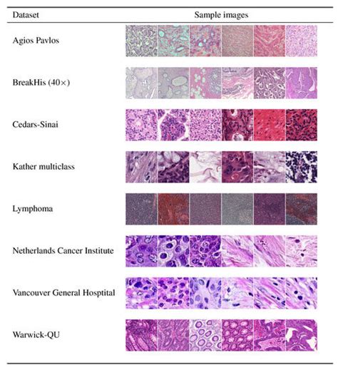 Experimental Assessment Of Color Deconvolution And Color Normalization For Automated