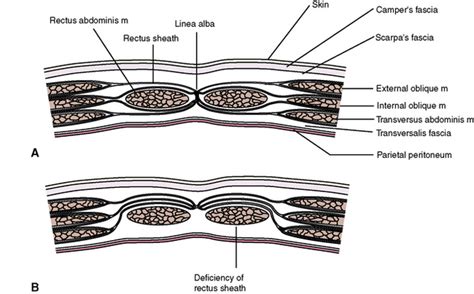 4 The Abdomen Pelvis And Perineum Pocket Dentistry