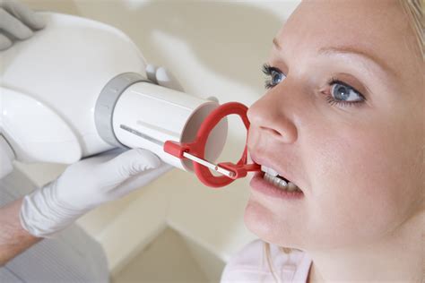 Rosens Rants Will Dental X Rays Give Me Cancer