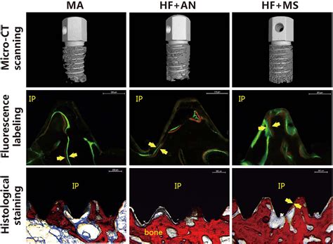 Figure 5 From Effects Of Different Hierarchical Hybrid Micro Nanostructure Surfaces On Implant