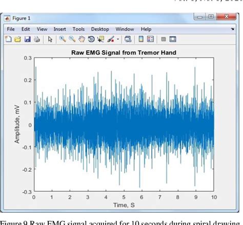 Figure 1 From Diagnosis Of Hand Tremor From Emg Sensors Semantic Scholar