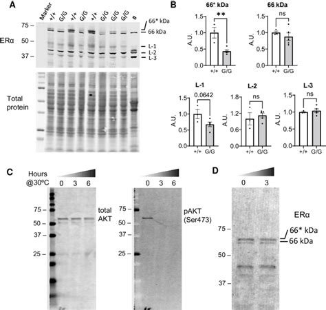 The Upper 66 Kda In The Liver Is Resistant To Spontaneous
