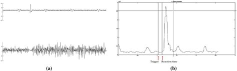 A Visual Estimate To Assess Emg Onset Detection The Reaction Time Was Download Scientific