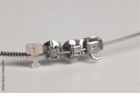 Macro Photo Of Dental Braces Without Teeth Dismounted From Mouth Nobody On The Picture Dental