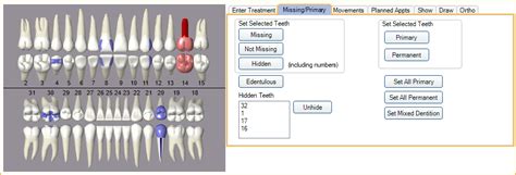Open Dental Software Missingprimary Teeth