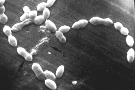 BSCI Streptococcus Images