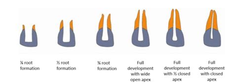 Pulp Therapy Of Immature Permanent Teeth Flashcards Quizlet