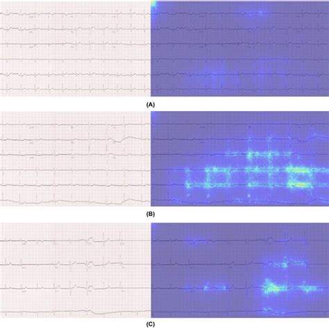 Inception V3 Diagram Of Inceptionv3 Network Architecture Showing Download Scientific Diagram