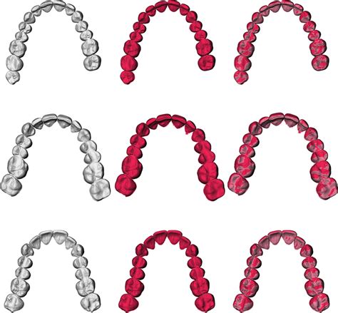 overview of maxillary teeth segmentations left manual segmentation
