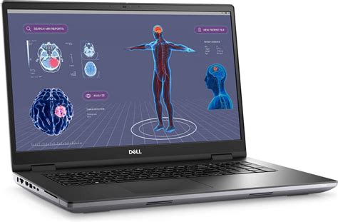 Dell Precision 7780 Workstation Laptop 17 Fhd Wva 60hz Display Intel