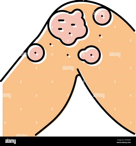 Atopic Dermatitis Color Icon Vector Illustration Stock Vector Image