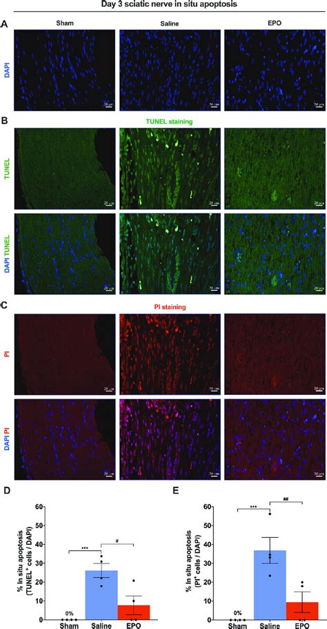 On Day 3 Epo Effectively Attenuates Sn In Situ Apoptosis Following