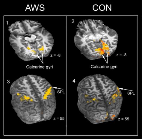 Reduced Activity In The Visual Spatial Processing Center Of The Brain During Aiws Raiws