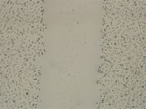 Analysis Of Scratch Assay Using Imagej Rlabrats