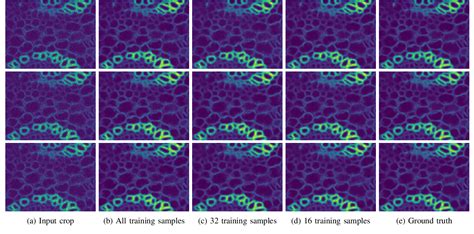Generalizable Denoising Of Microscopy Images Using Generative Adversarial Networks And