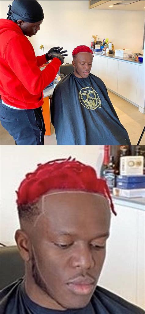 Jj Getting Ready For Forehead Reduction Surgery After Being Bullied All
