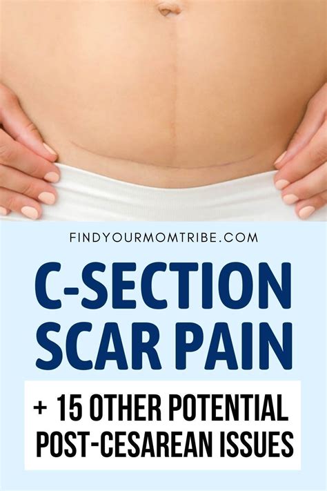 C Section Recovery Timeline And Return To An Exercise Plan After A