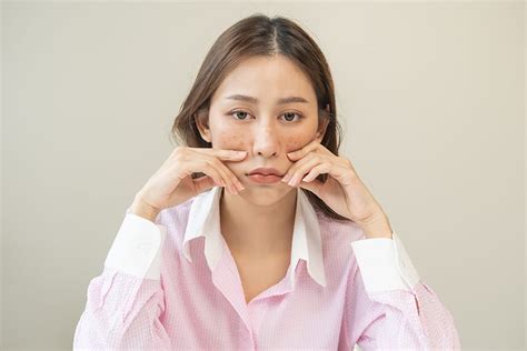 Lupus Gejala Penyebab Dan Pengobatan