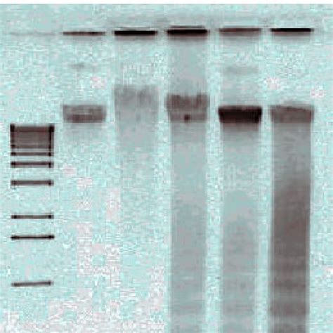 Apoptotic Dna Fragmentation In Serum Deprived Retinal Ganglion Cell 5 Download Scientific