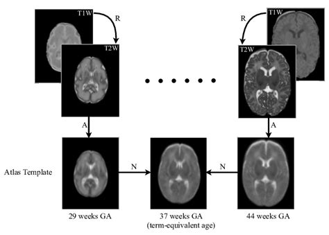 The Registrations Applied To The Multi Modal Longitudinal Data In Our Download Scientific