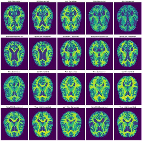 A Quantitative Approach For Evaluating Disease Focus And