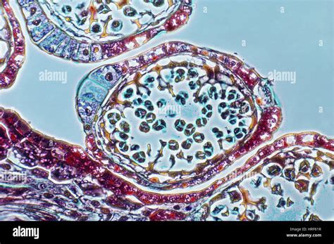 Fern Sori Microscope