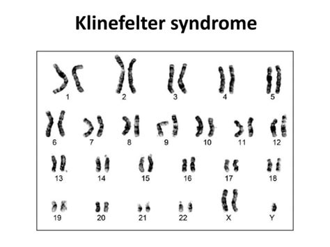 Karyotype And Fish Pptx