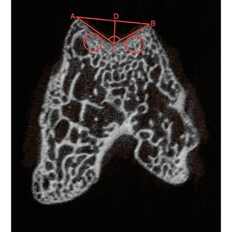 Measurement Diagram Dc Trochlear Depth Acb Sulcus Angle Download Scientific Diagram