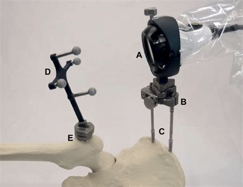 The Intellijoint Hip 3d Mini Optical Navigation Tool Notes The Camera